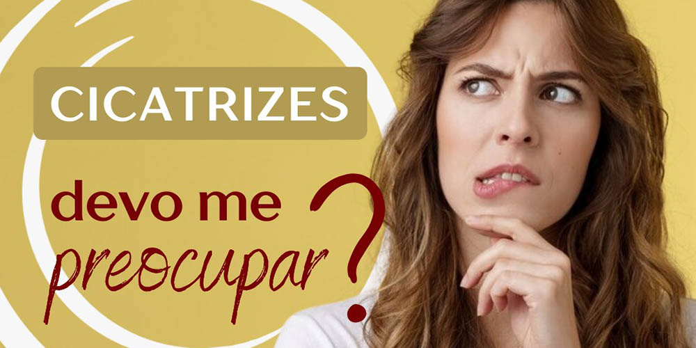 Cicatrizes, devo me preocupar? - Dr. Veimar Roberto Zortéa - Cirurgião ...